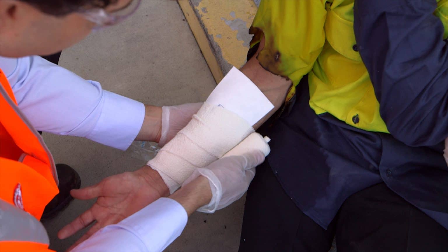 Burns Safety Training - Safetyhub